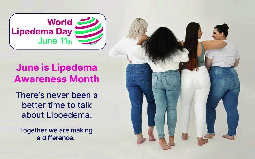Lipoedema UK – Together we will beat lipoedema!